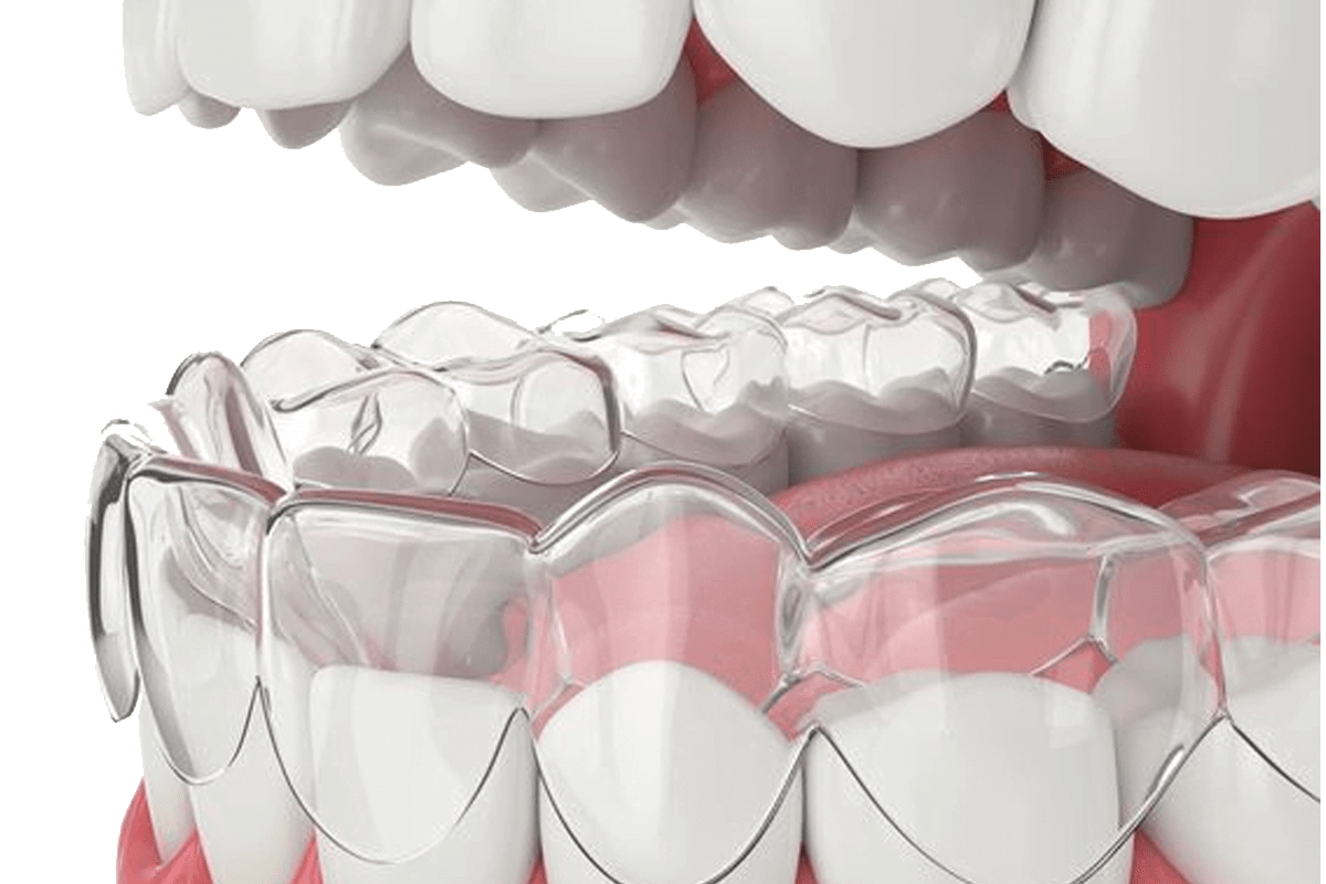 Layanan - Smart Dental