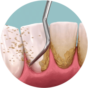 Smart Dental Care - Smart Dental